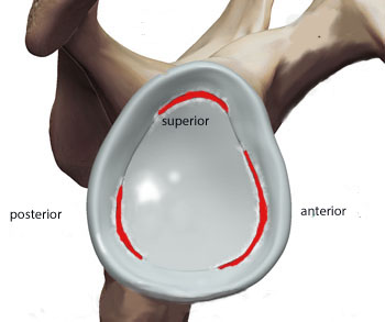 Labral Repair – Katherine Burns, M.D.